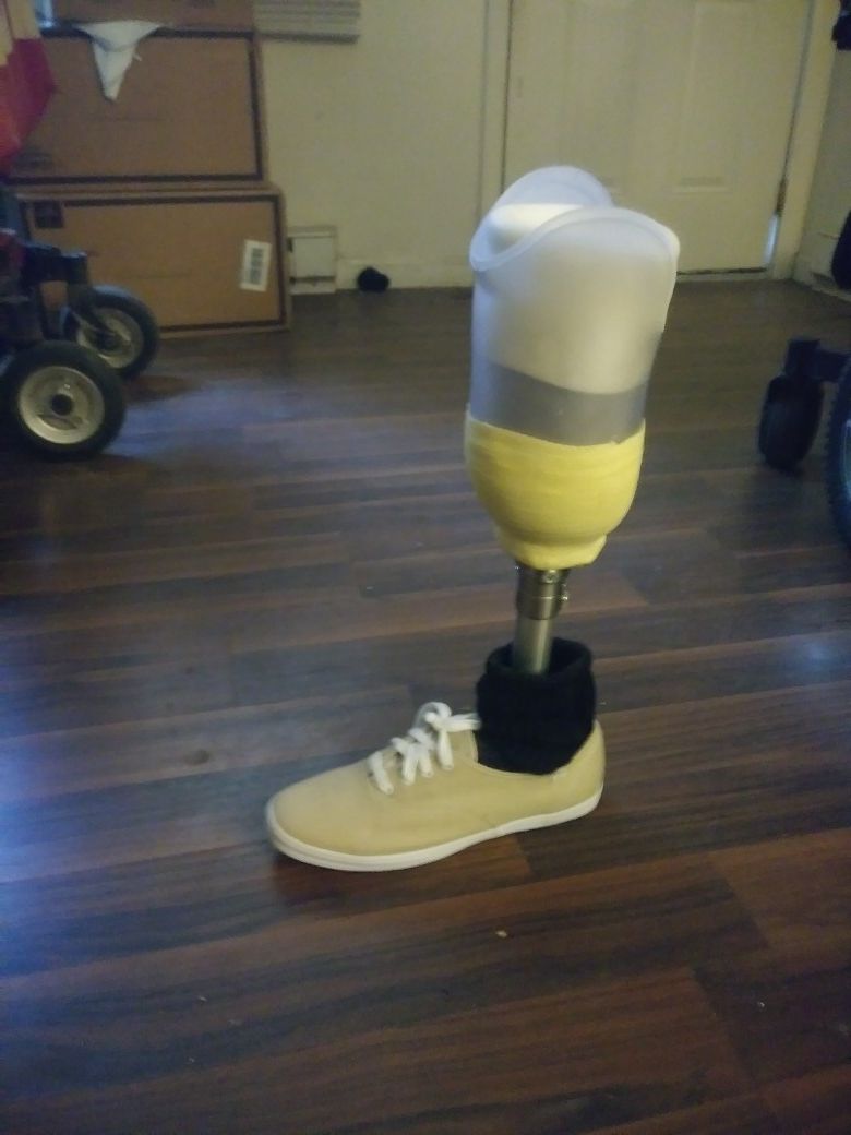 Titanium to the knee prosthetic leg with suction top just below knee ...